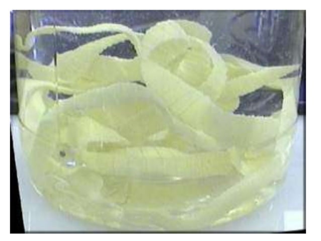 Diphyllobothrium latum | PPTX | Infectious Diseases | Diseases and ...