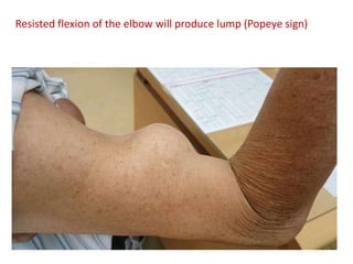 D. Ihsan Rotator Cuff Disorders-4 (Muhadharaty).pptx