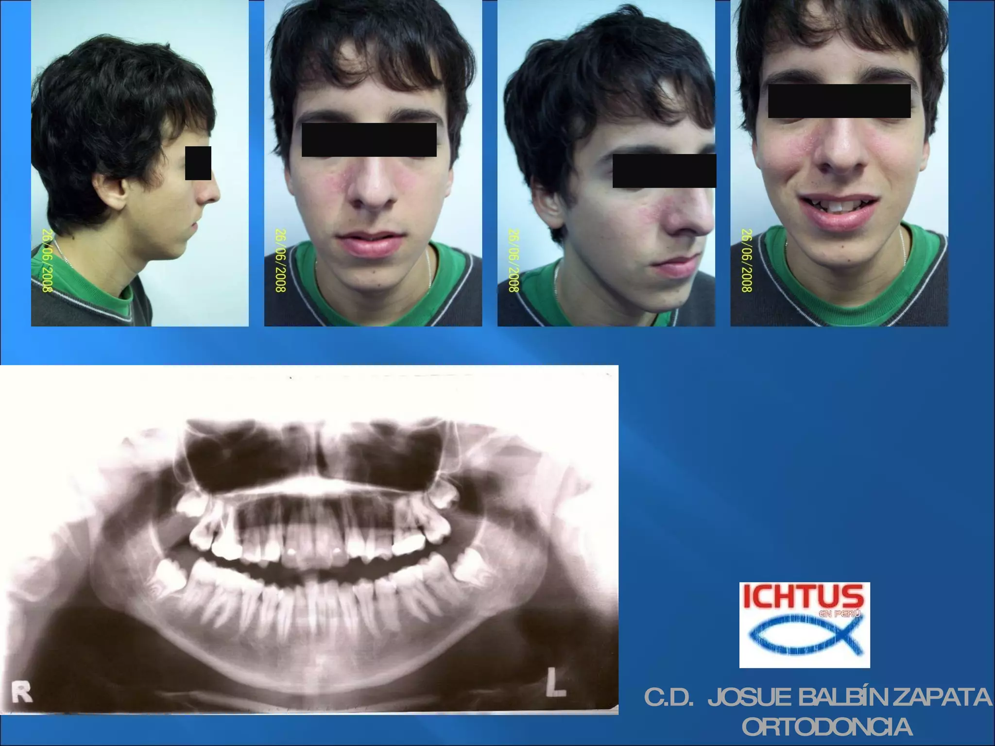 CASOS CLINICOS | PPT