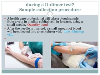 D dimer test and sample collection procedure | PPTX