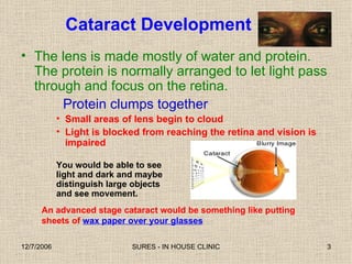 D l Cataract Iinformation | PPT