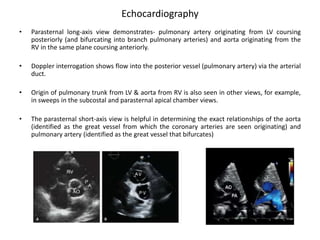 D tga, echo & hemodynamic features of | PPT