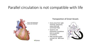 D transposition of great arteries | PPT