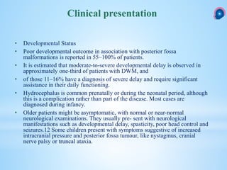 Dandy Walker syndrome | PPTX