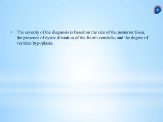 Dandy Walker syndrome | PPTX