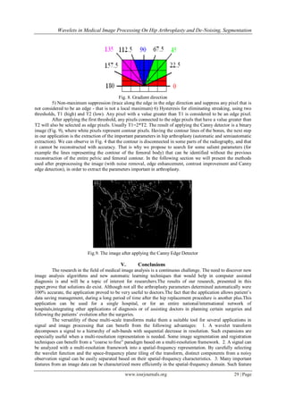 Wavelets in Medical Image Processing On Hip Arthroplasty and De-Noising, Segmentation | PDF