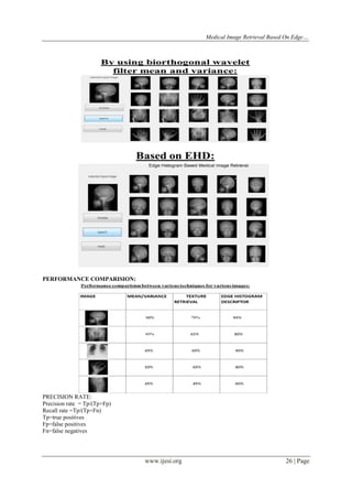 Medical Image Retrieval Based On Edge Histogram Descriptor | PDF