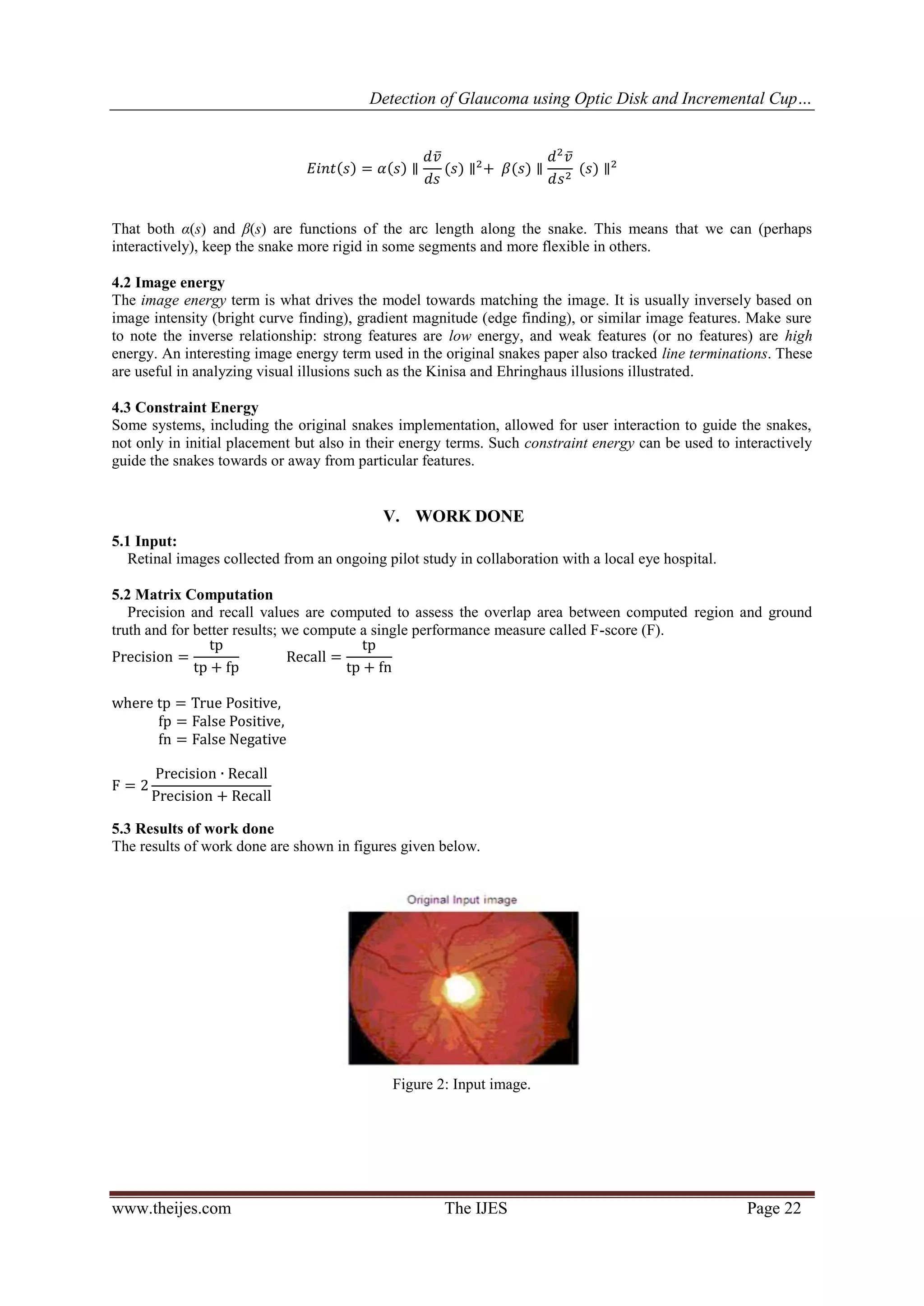 Detection Of Glaucoma Using Optic Disk And Incremental Cup Segmentation