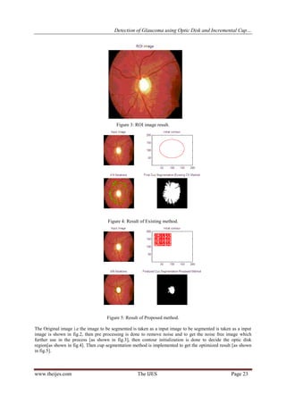 Detection of Glaucoma using Optic Disk and Incremental Cup Segmentation from Retinal Image | PDF ...