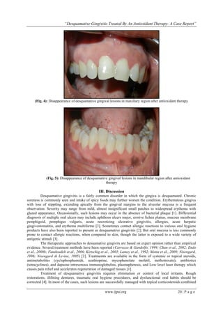 “Desquamative Gingivitis Treated By An Antioxidant Therapy- A Case Report” | PDF