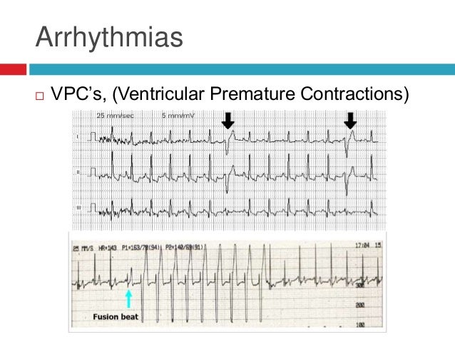 Cardiology Basics