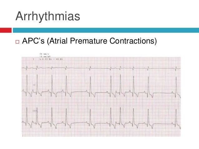 Cardiology Basics