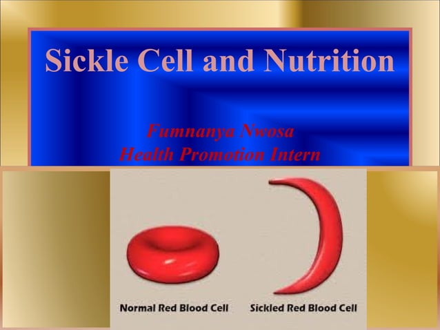 Sickle Cell and Nutrition Powerpoint Presentation | PPT