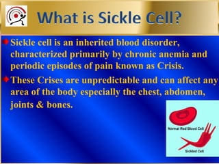 Sickle Cell and Nutrition Powerpoint Presentation | PPT