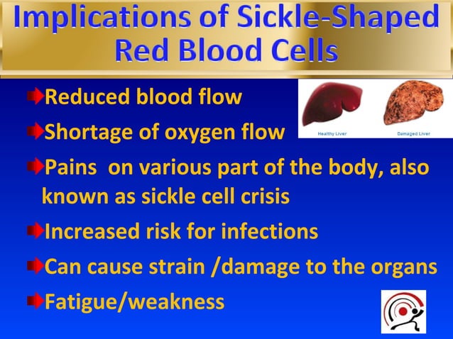 Sickle Cell and Nutrition Powerpoint Presentation | PPT