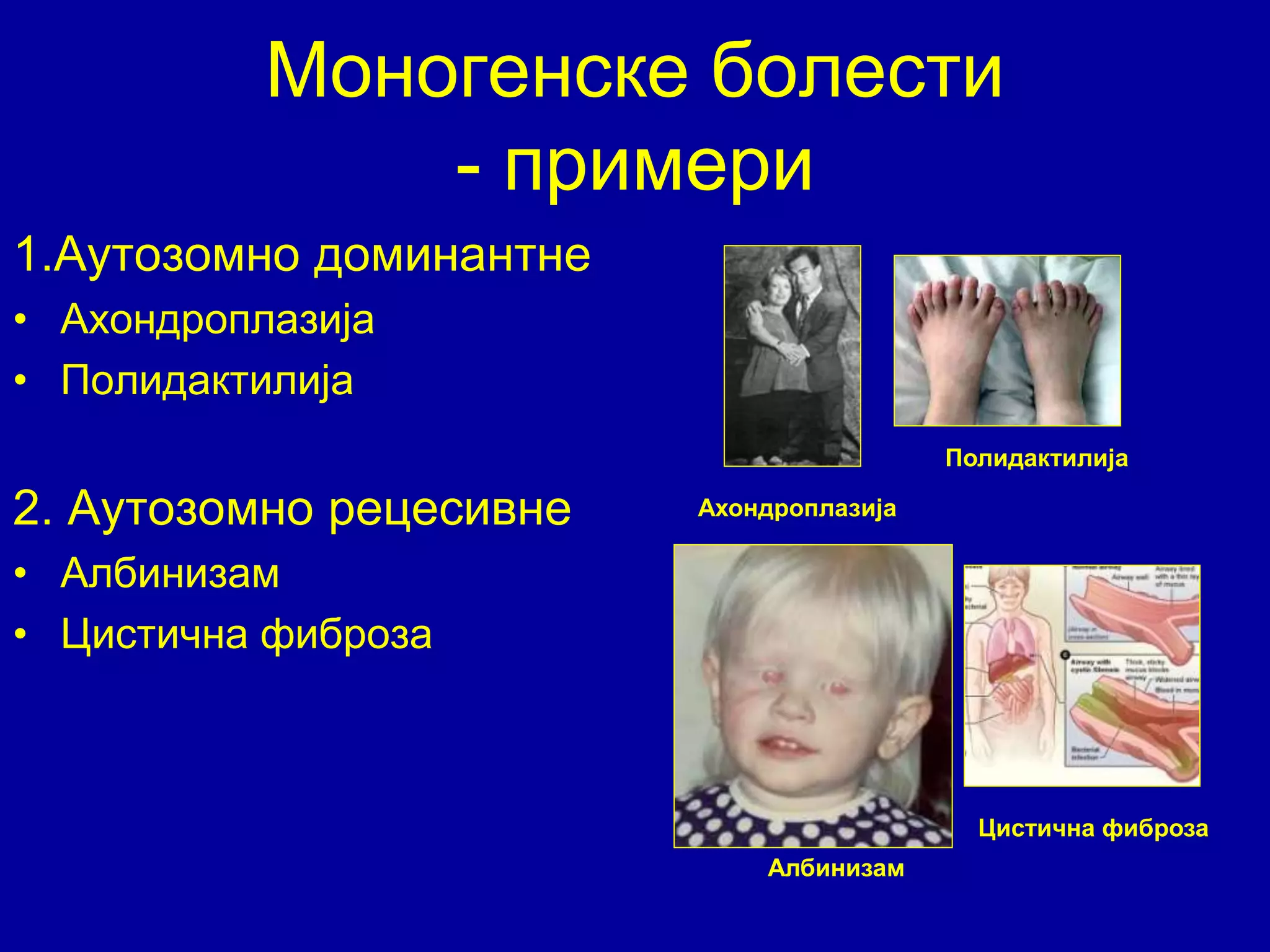 Nasledne bolesti coveka | PPT