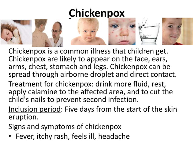 Common Childhood Illnesses | PPTX | Infectious Diseases | Diseases and ...