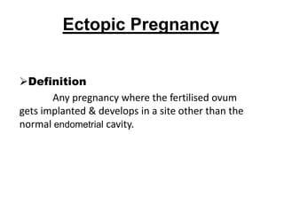 ECTOPIC PREGNANCY | PPTX