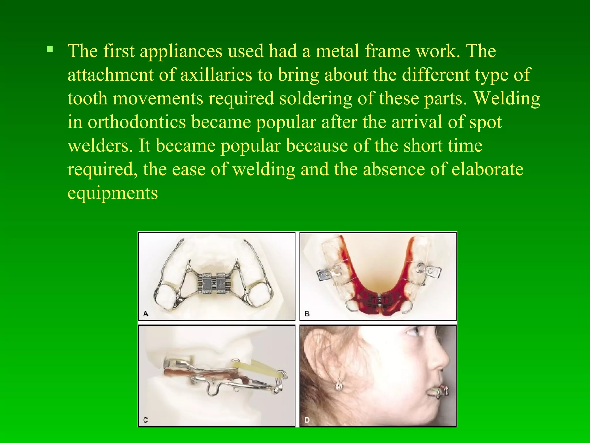 dental soldering | PPT