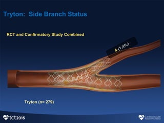 J.Schneider, how tryton will change daily practice | PDF