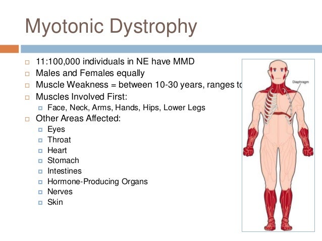 Muscular Dystrophy Presentation (Final)