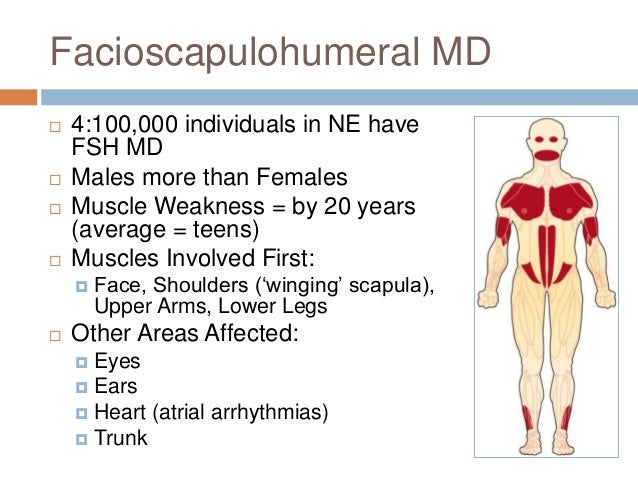 Muscular Dystrophy Presentation (Final)