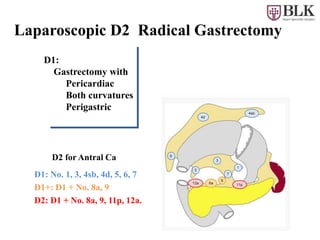 D2 gastrectomy | PPTX