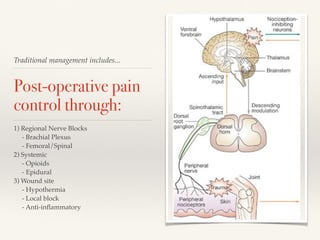 Presentation | PDF