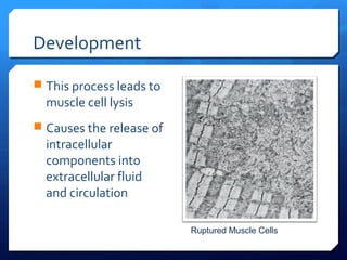 Rhabdomyolysis | PPT