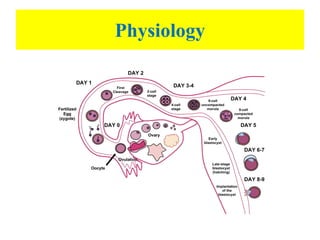 Day3 versus Day5 Embryo Transfer | PPTX