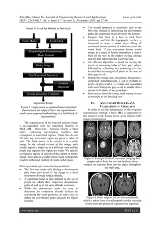 MRI Image Segmentation Using Gradient Based Watershed Transform In Level Set Method for a ...