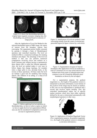 MRI Image Segmentation Using Gradient Based Watershed Transform In ...