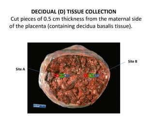 placental dissection | PPTX | Pregnancy | Reproductive Health