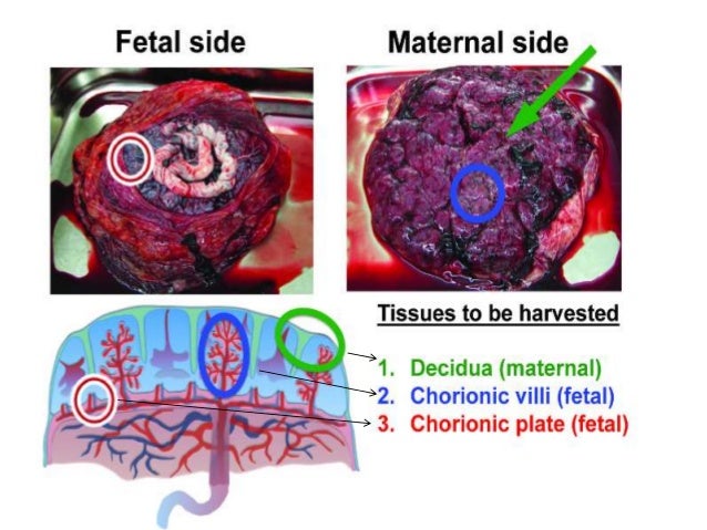 Placental Dissection