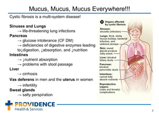 cystic fibrosis STUDENT version | PDF | Lung and Respiratory Health ...