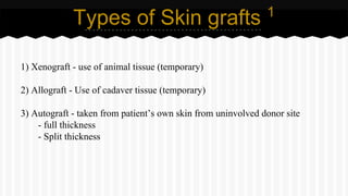 Burns inservice | PPT