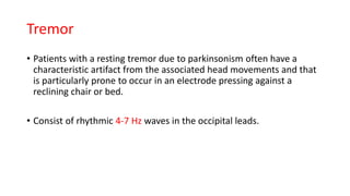 EMG artifact presentation | PPTX
