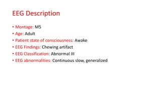 EMG artifact presentation | PPTX