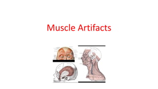 EMG artifact presentation | PPTX