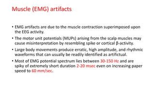 EMG artifact presentation | PPTX