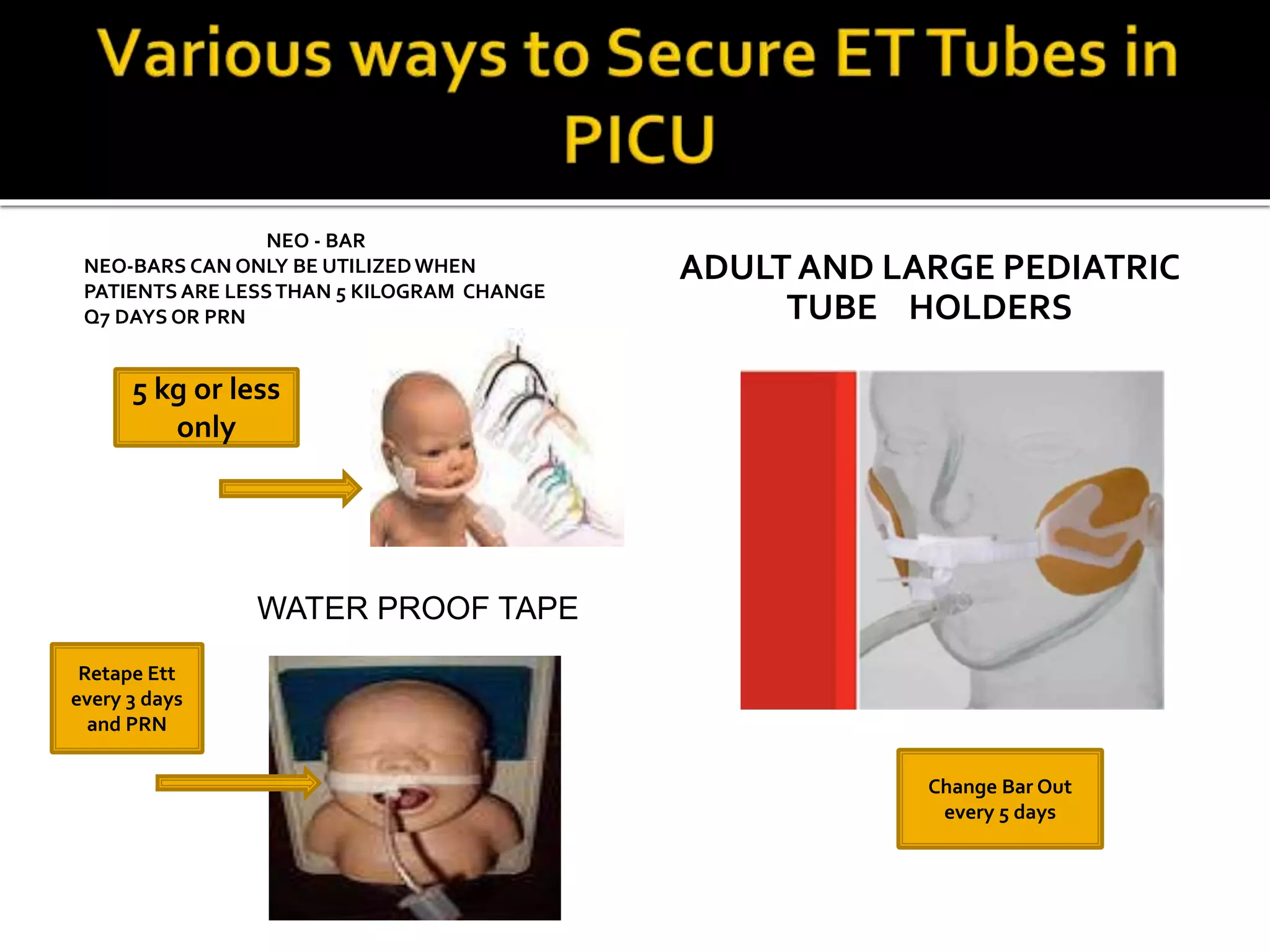 Critical Care Airway Management5 (3) | PPTX