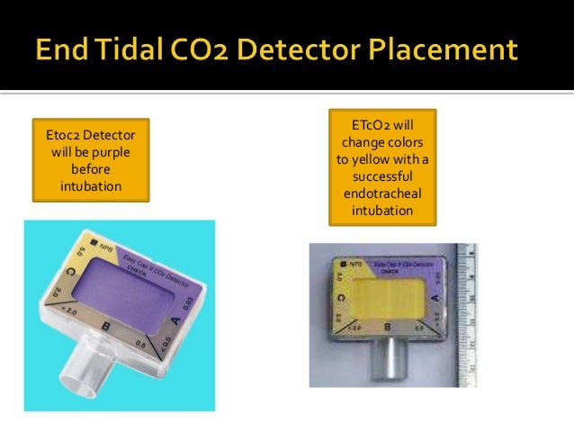 Critical Care Airway Management5 (3)