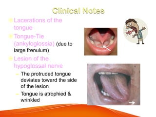 14-ORAL CAVITY | PPT