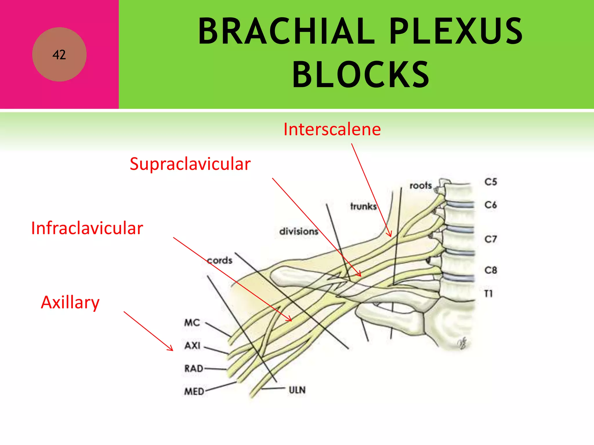 Peripheral Nerve Block Part 2 | PPTX | Death, Injury, or Military ...