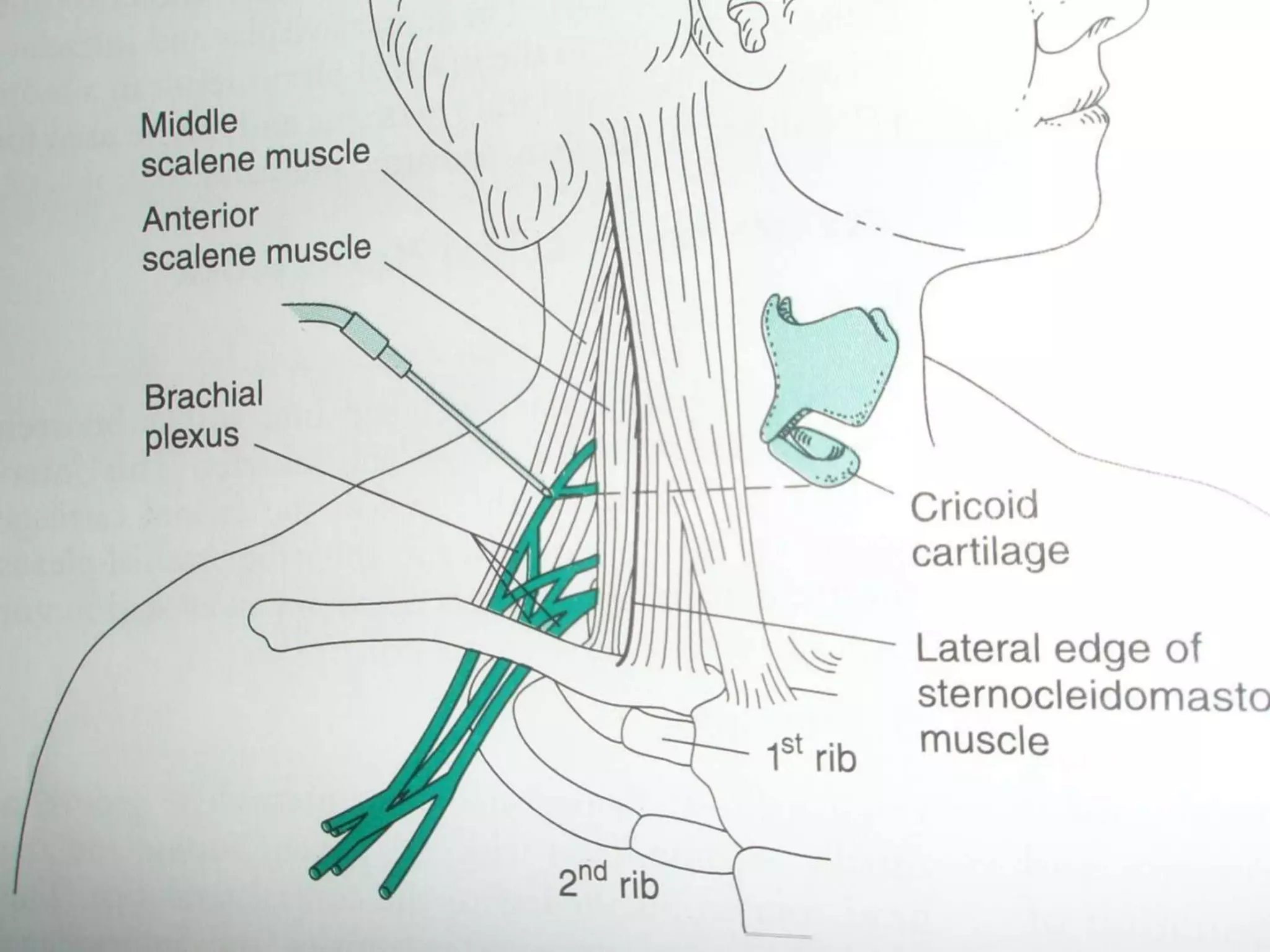 Peripheral Nerve Block Part 2 | PPTX
