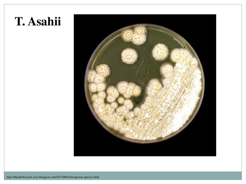 Fungemia in the Setting of Acute Lymphocytic Leukemia (FINAL)-1