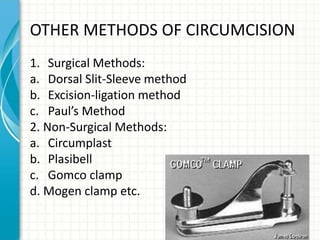PAUL'S CIRCUMCISION | PPT