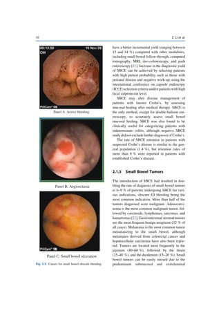 Handbook of capsule endoscopy | PDF | Digestive Disorders | Diseases ...