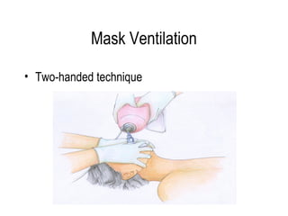 Airway | PPT