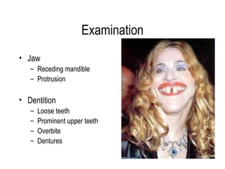Airway | PPT